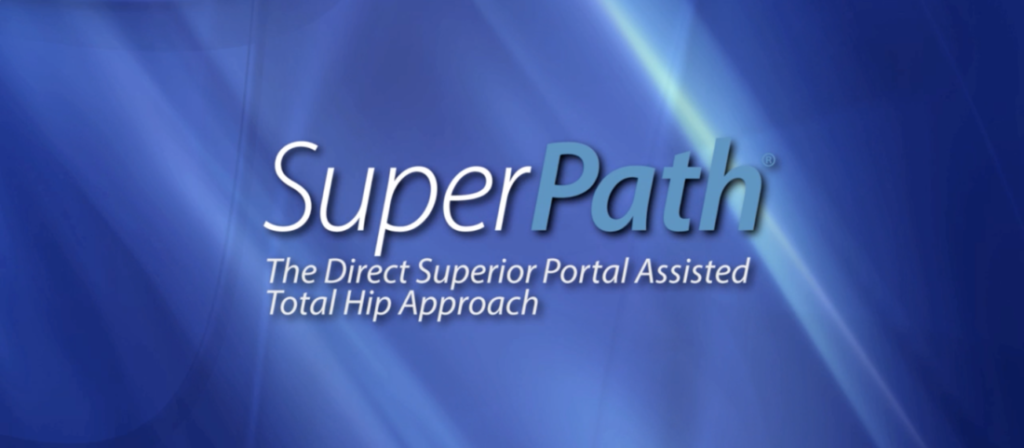 SuperPATH Animation - Video - Capstone Orthopedics